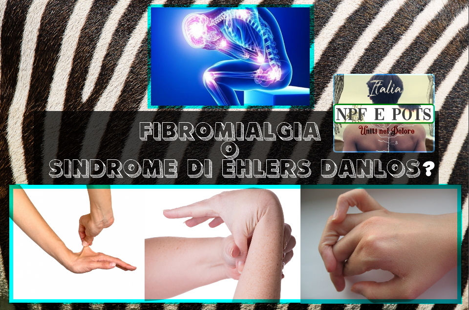 Fibromialgia o sindrome di Ehlers-Danlos?
