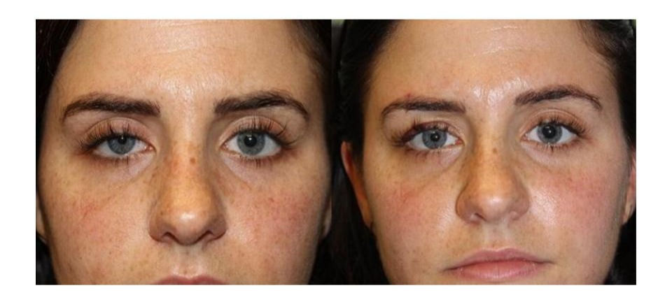 Optometry | Eyecare Redefined | Katy