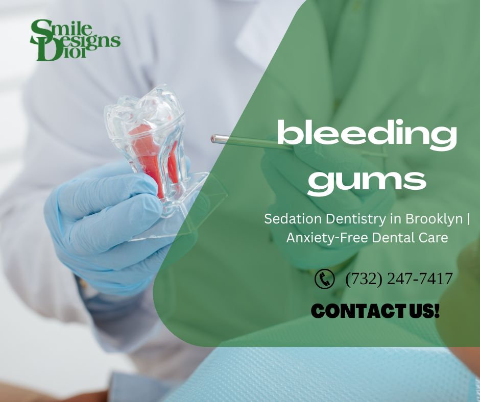 Vitamin Deficiency and Bleeding Gums
