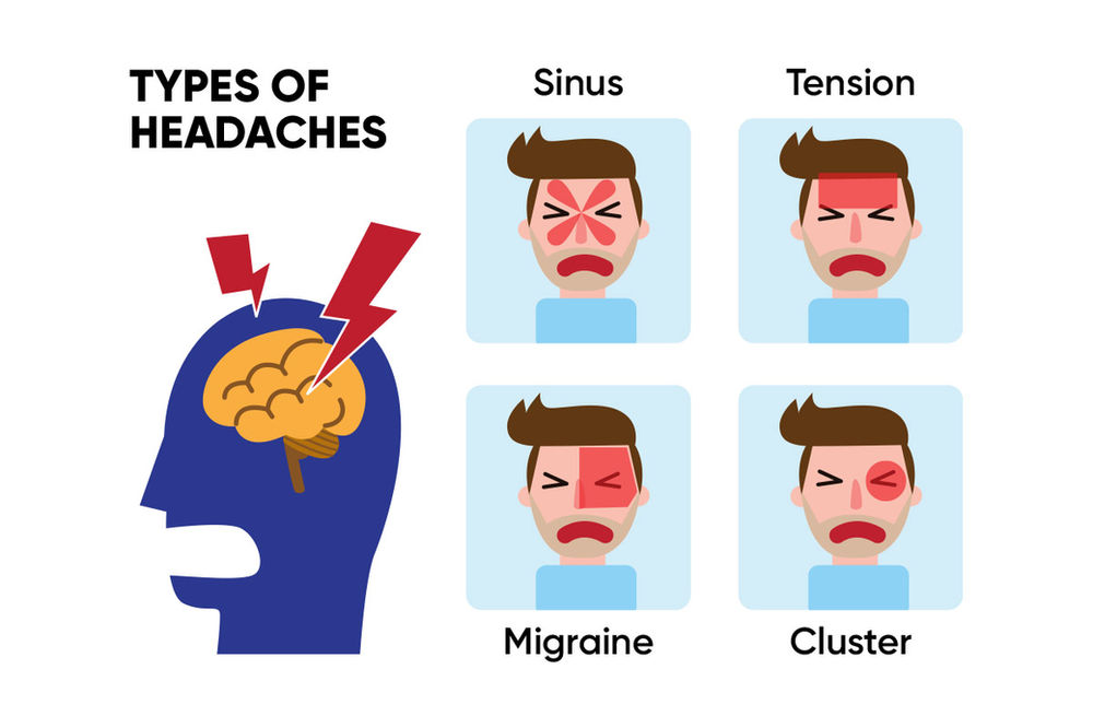 Most Common Types of Headaches and Their Surprising Causes