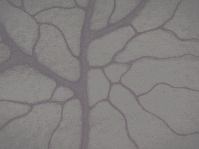 AVC | DR. GUSTAVO MELO DE ANDRADE LIMA