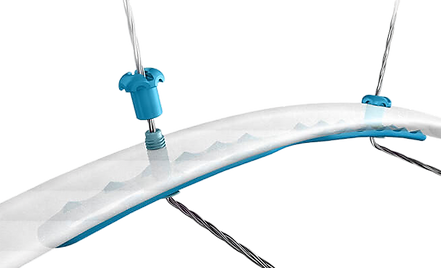 RibFix Advantage | Selective Surgical