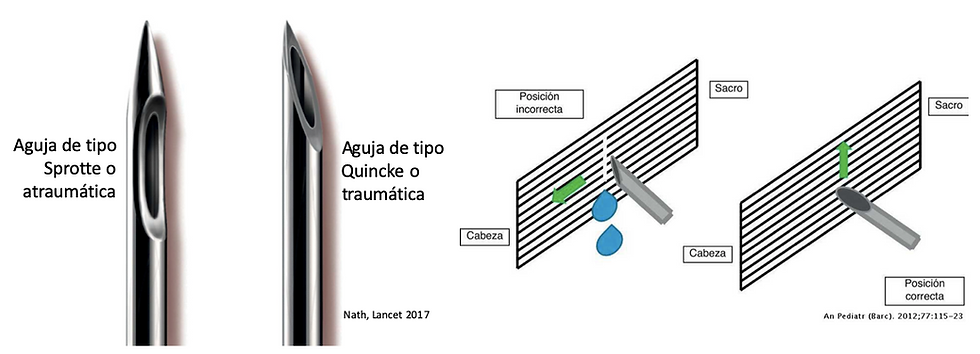 #60 ¿Cuál es la mejor aguja para realizar una punción lumbar en un neonato?