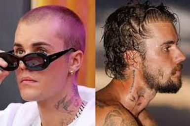 Justin Bieber Hair Transplant: An Overview of Justin’s Hairline