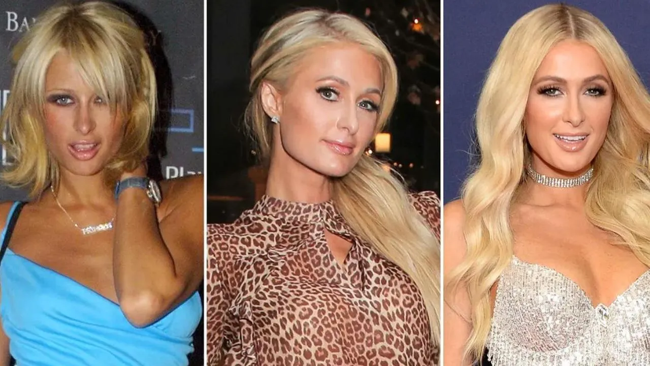 Paris Hilton Plastic Surgery
