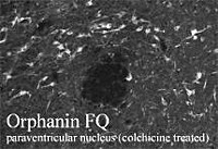 Orphanin FQ/Nociceptin | medico