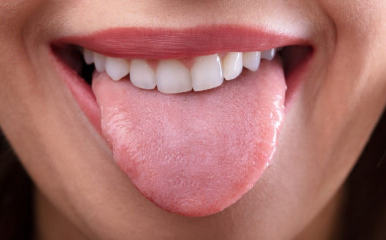 LA SALUD DE LA LENGUA