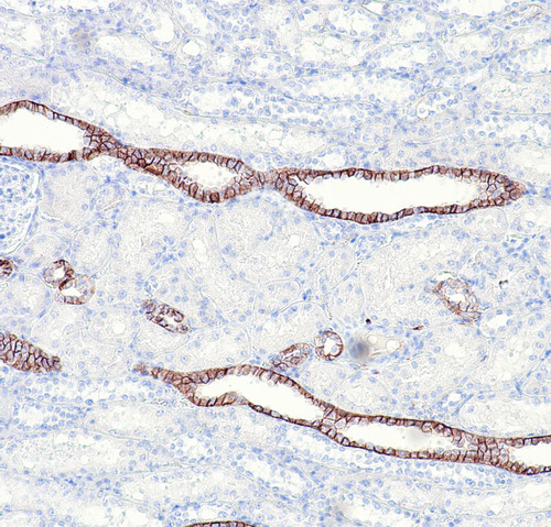 Anti-CD171/ L1CAM (clone QR039) | Lab Path Experts