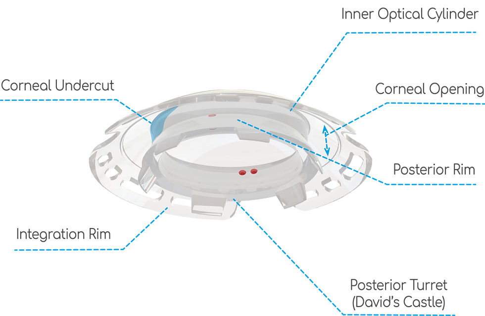 Artificial Cornea | CorNeat Vision | Revolutionary Ophthalmic Implants