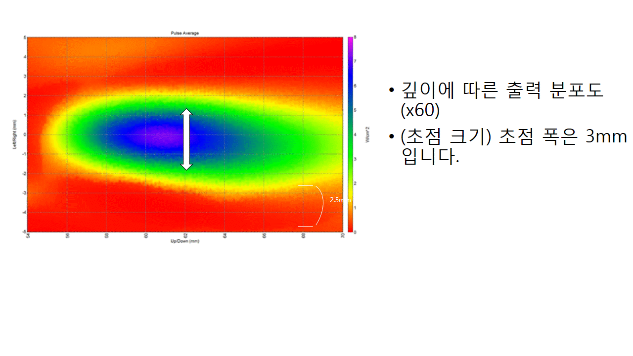 측정 | ultrafocus
