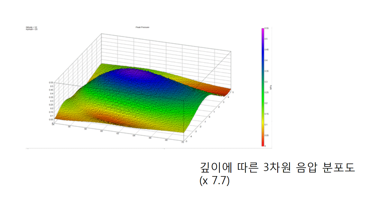 측정 | ultrafocus