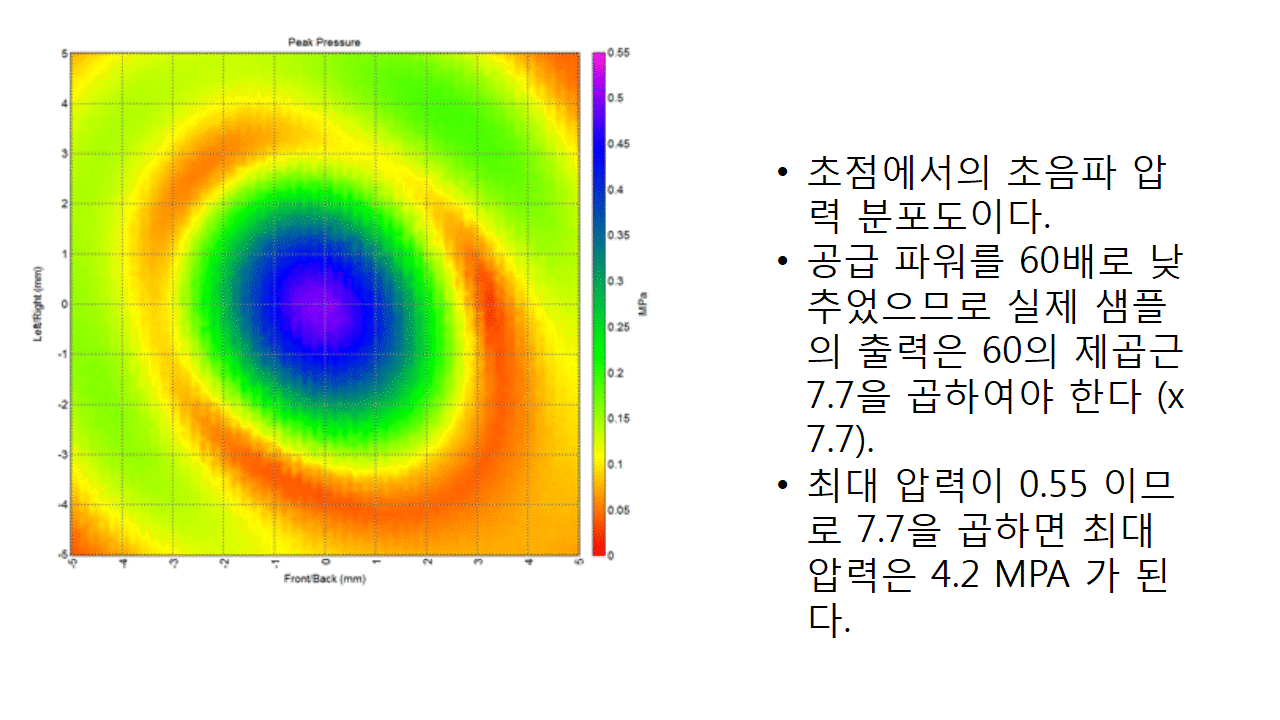 측정 | ultrafocus