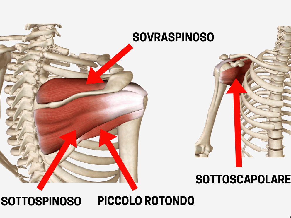 LA CUFFIA DEI ROTATORI: cos'è e come viene trattata in caso di lesione