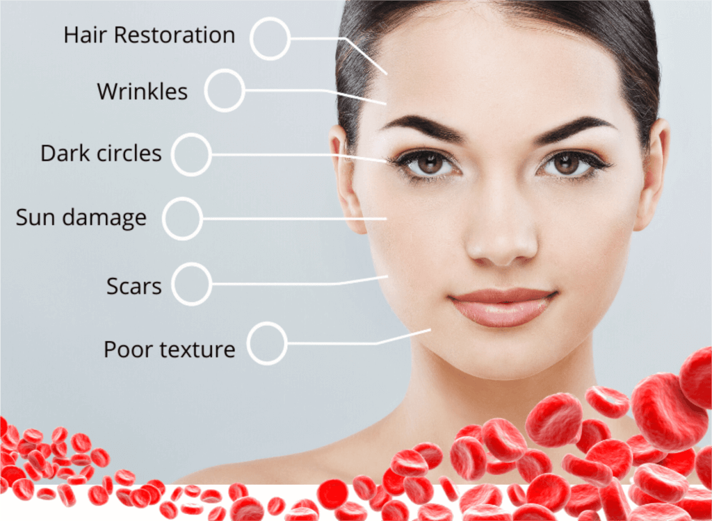 PRF Injections | PRF EZ Gel