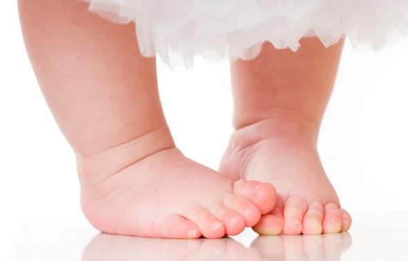 In-toeing In Children