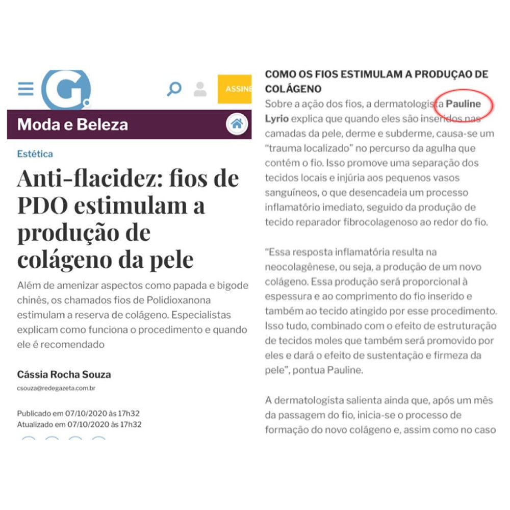 Anti Flacidez Fios De Pdo Estimulam A Produção De Colágeno Da Pele