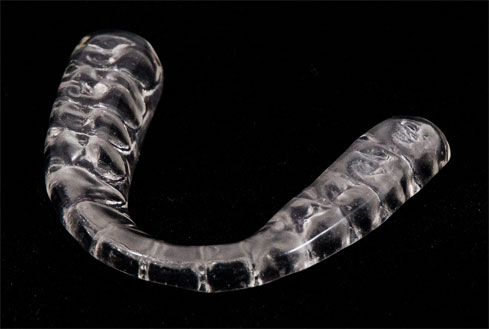 Guarda Oclusal y Bruxismo | Baena Dentista Queretaro