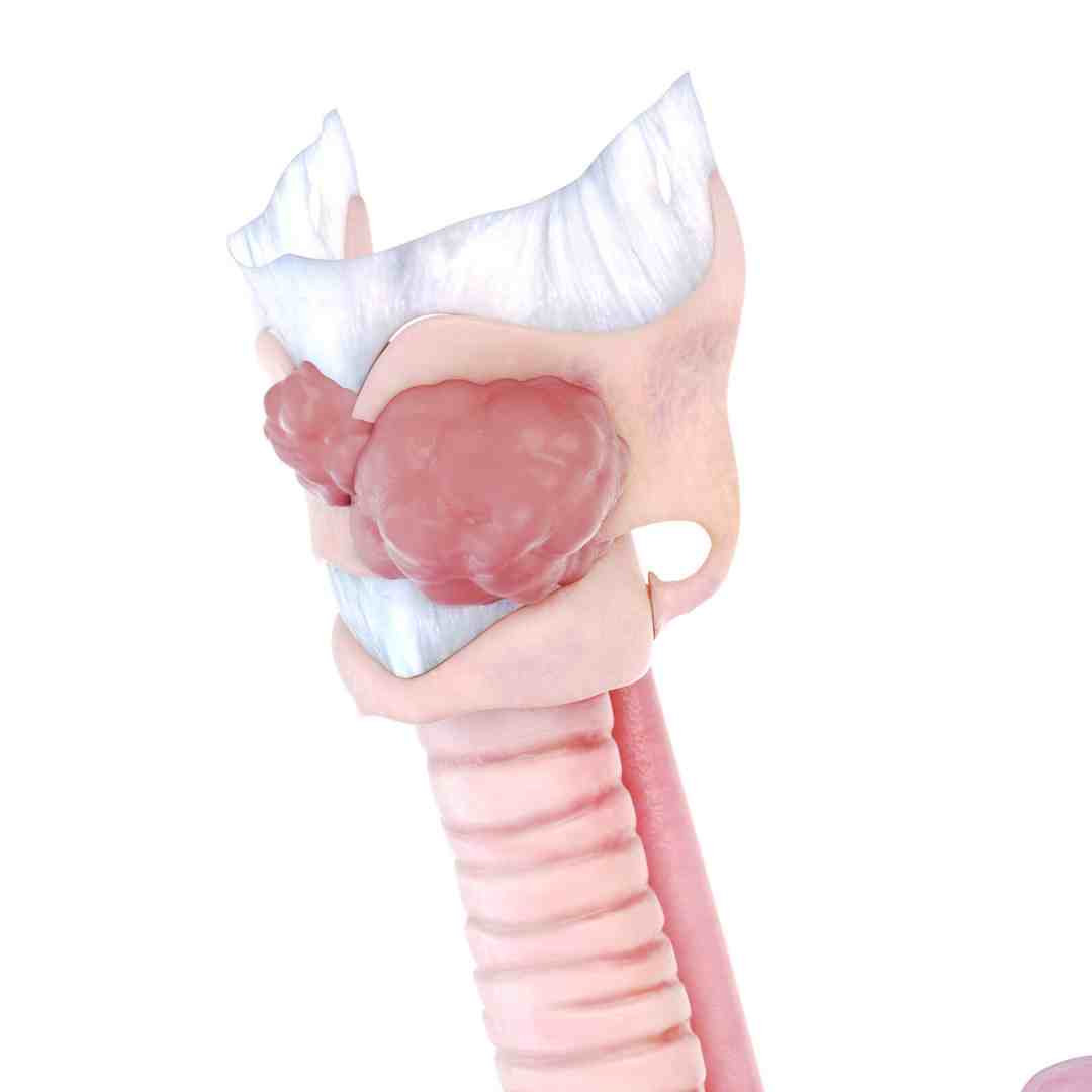 Laryngeal cancer