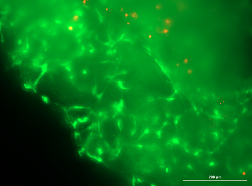 Human Vascular ECM hydrogel | Preci