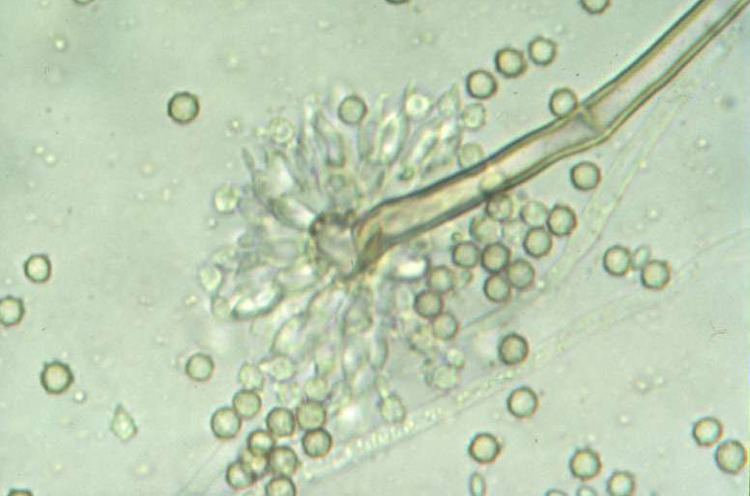 Aspergillus ustus
