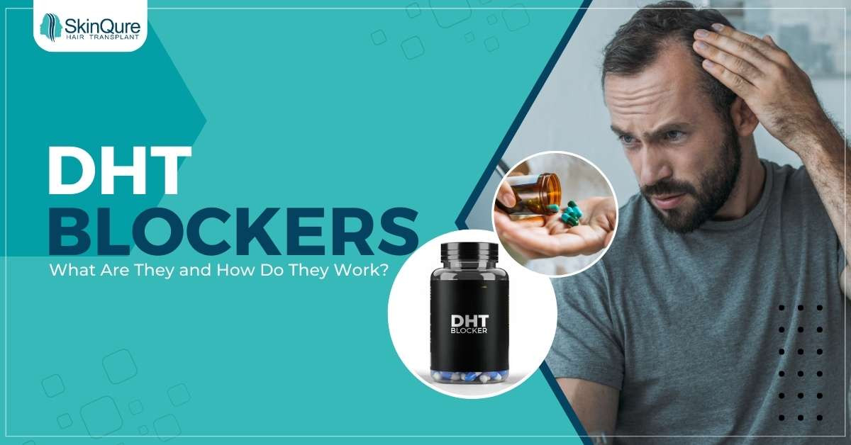 DHT Blockers: What Are They and How Do They Work?