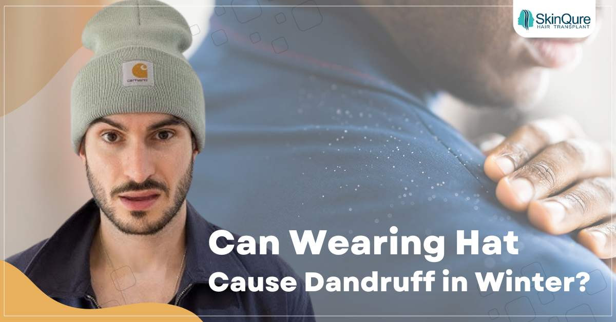 Can Wearing Hats Cause Dandruff in Winter?