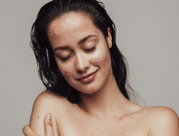 Fresh Skin Clinic Perth: Rejuvenating Facial Skin Treatments