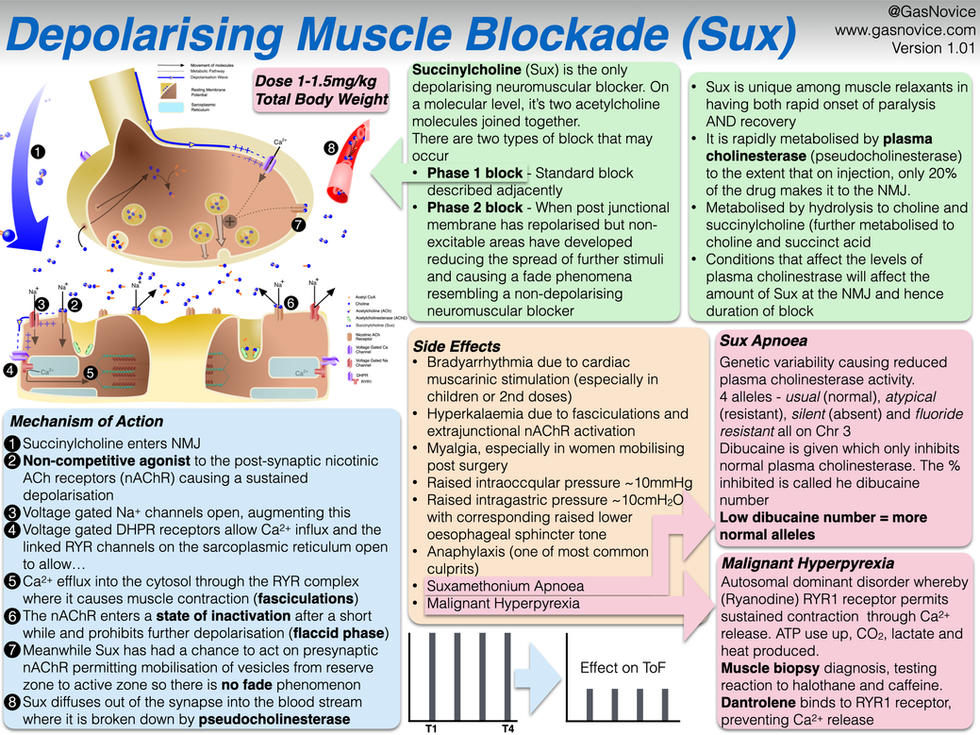 Anaesthetic Infographics