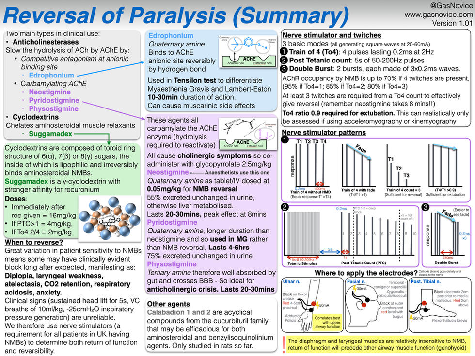 Anaesthetic Infographics