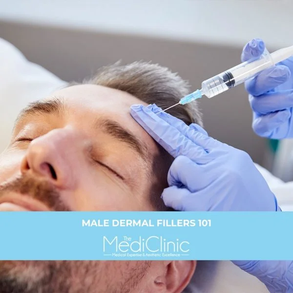 Male Dermal Filler Treatments
