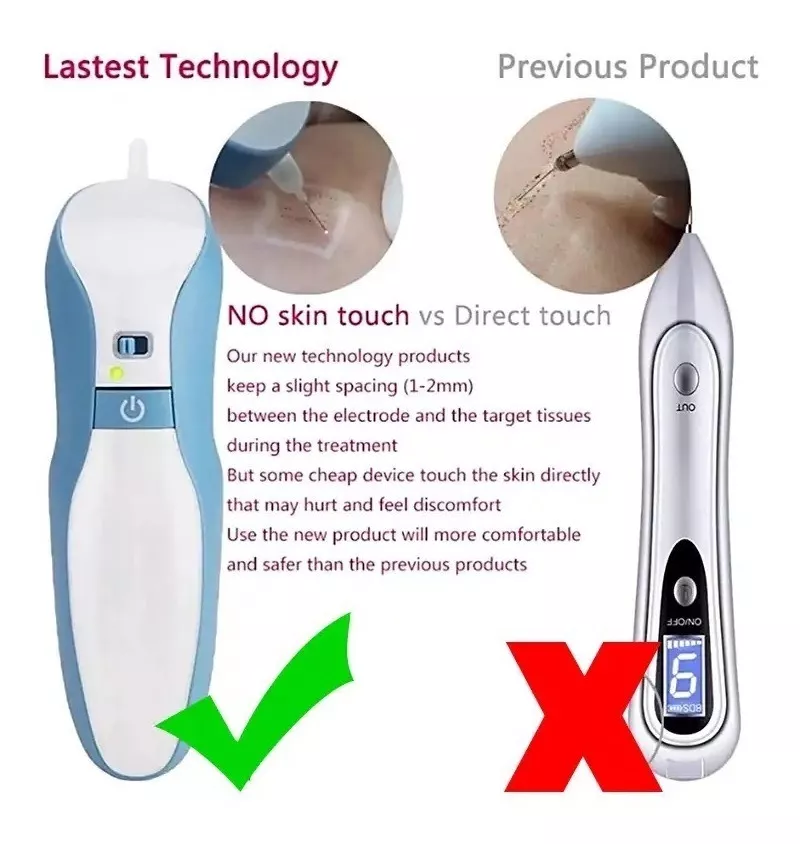 Eliminador De Manchas, Pecas, Verrugas Etc/plasma Pen Maglev | Kimalebeauty