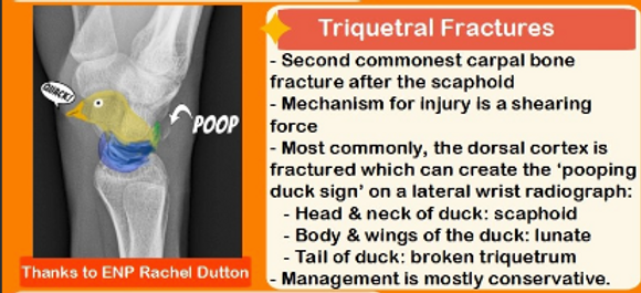 Triquetral Fractures