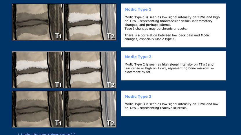 Rachis | ICVNS - PARIS