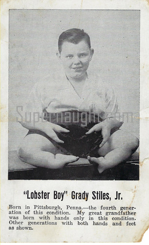 Grady Stiles Lobster Boy Signed Sideshow Card | Supernaught