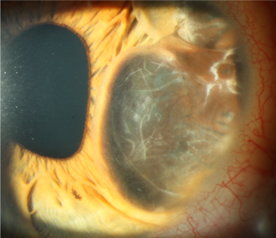 Eye and Eyelid Care | London | Ophthalmology | London, UK |vp-eyes.com