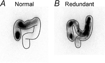 Om siden | My Site 1