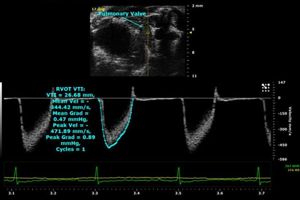 VEVO 3100 High-Frequency Ultrasound | optic