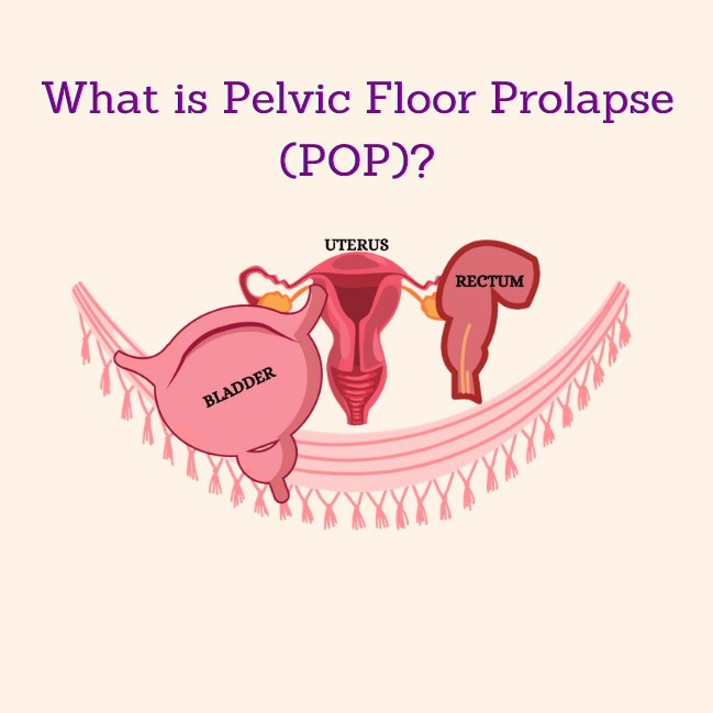 Conditions We Treat | Pelvic Elements, Pelvic Floor Physical Therapy ...