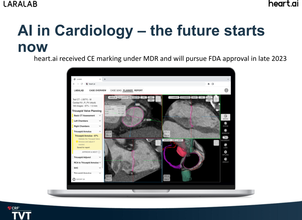Presentation AI in Cardiology | LARALAB