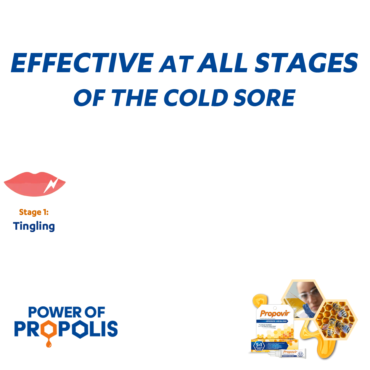 Propovir Cold Sore Cream