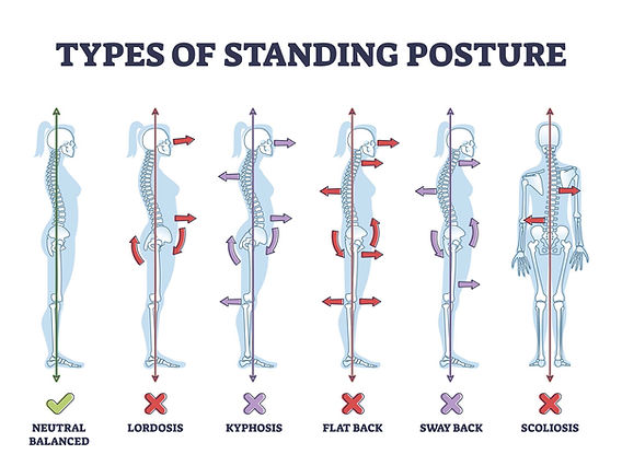 different back postures