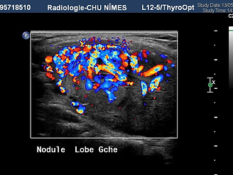 Dr SHARARA | Score EU TIRADS | ThyroNews