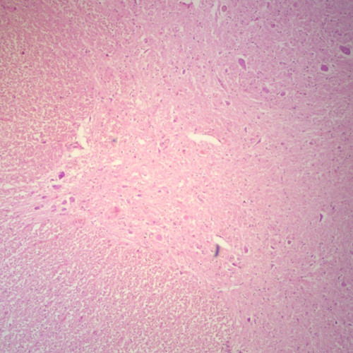 Human Spinal Cord Microscope Slide | Carolina Singapore