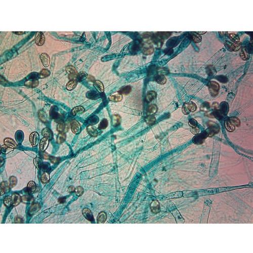 Allomyces Sporophyte Microscope Slide | Carolina Singapore