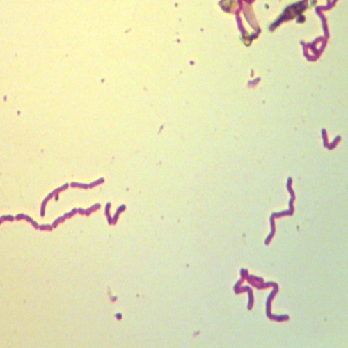 Haemophilus influenzae, w.m., Microscope Slide | Nantah Capital 2022
