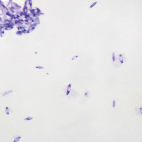 Clostridium tetani, Microscope Slide | Carolina Singapore