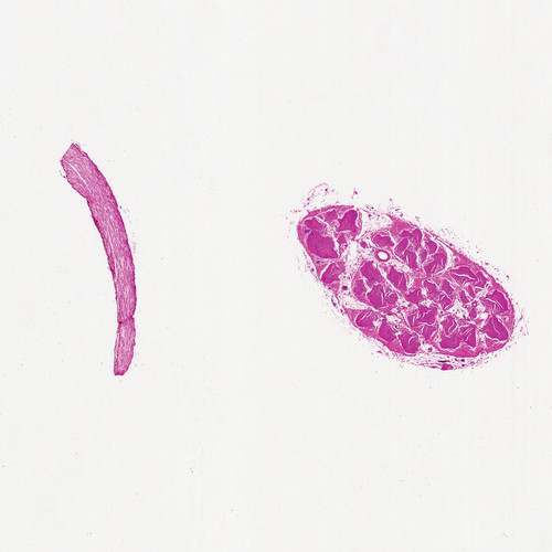 Human Nerve Microscope Slide | Nantah Capital 2022