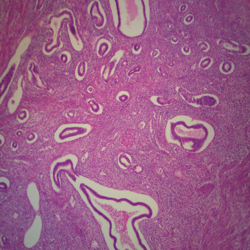 Human Uterus Microscope Slide | Carolina Singapore