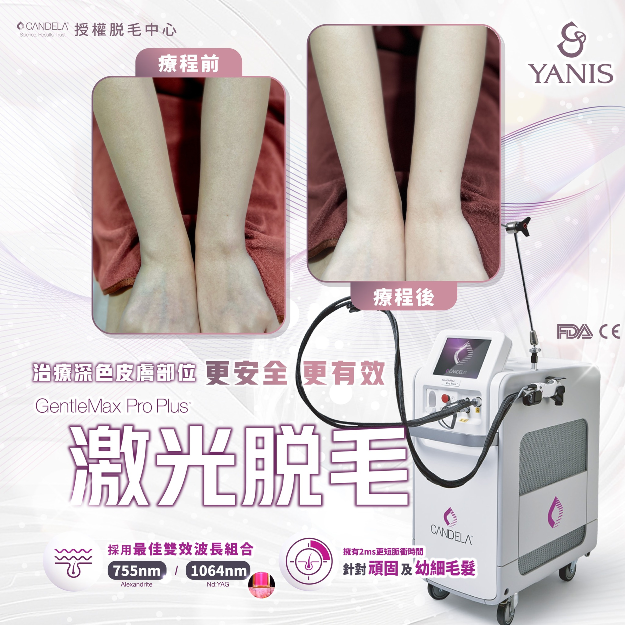 4大脫毛儀器比較！ Yanis Beauty・領先引進\脫毛界頂級版Candela GentleMax Pro Plus™️／終極脫毛美膚方案。https://static.wixstatic ...