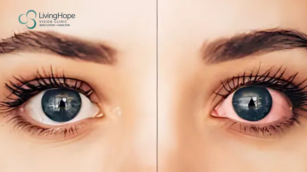 The Importance of Regular Eye Exams: How Overlooking Vision Health Can ...